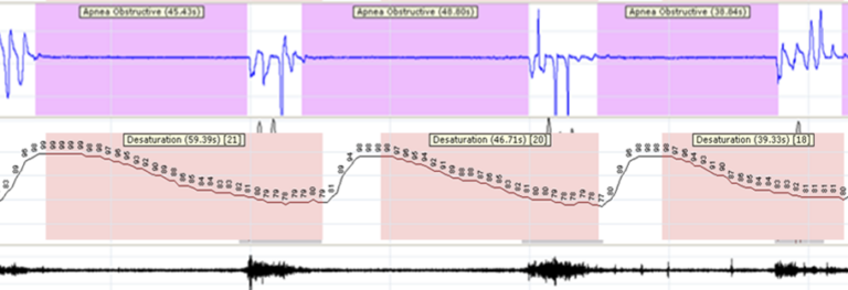 Zentrum für Schlafmedizin | American Sleep Clinic – Frankfurt am Main