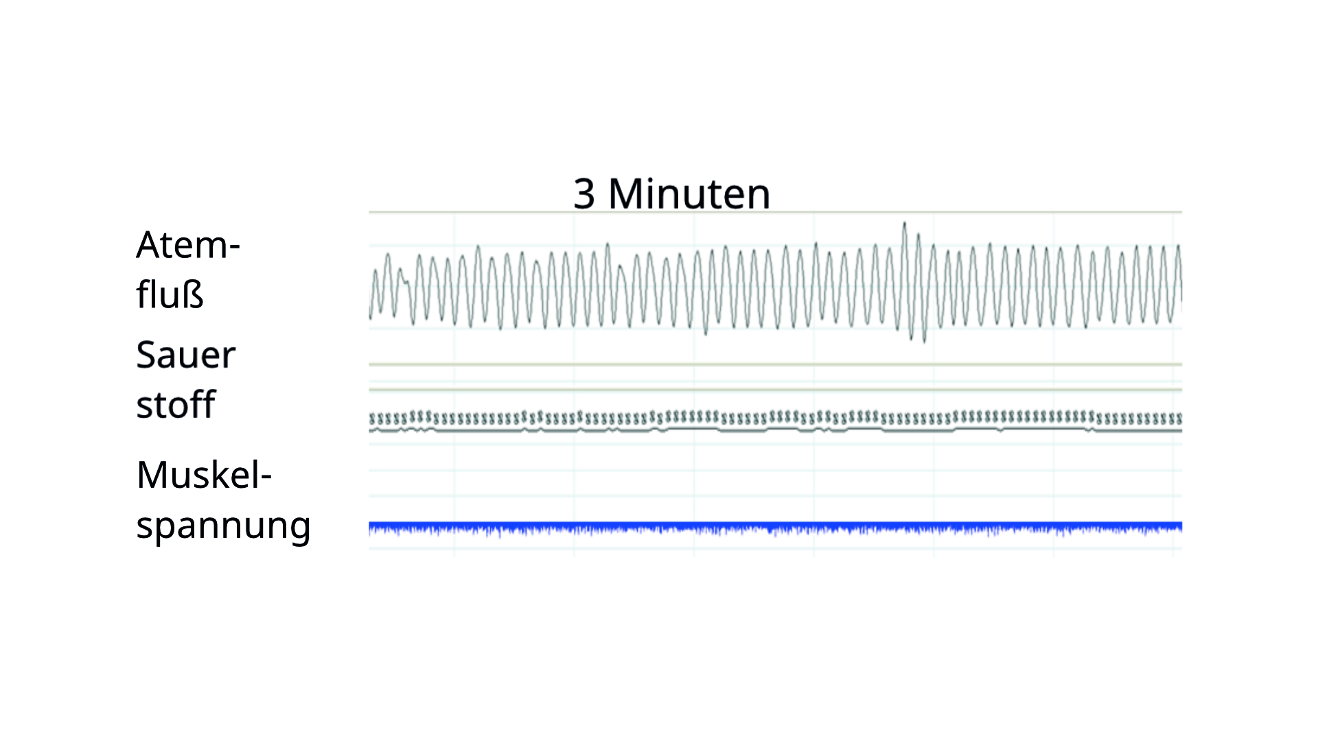 Schlaf- und Atmungsstörungen — American Sleep Clinic Frankfurt am Main