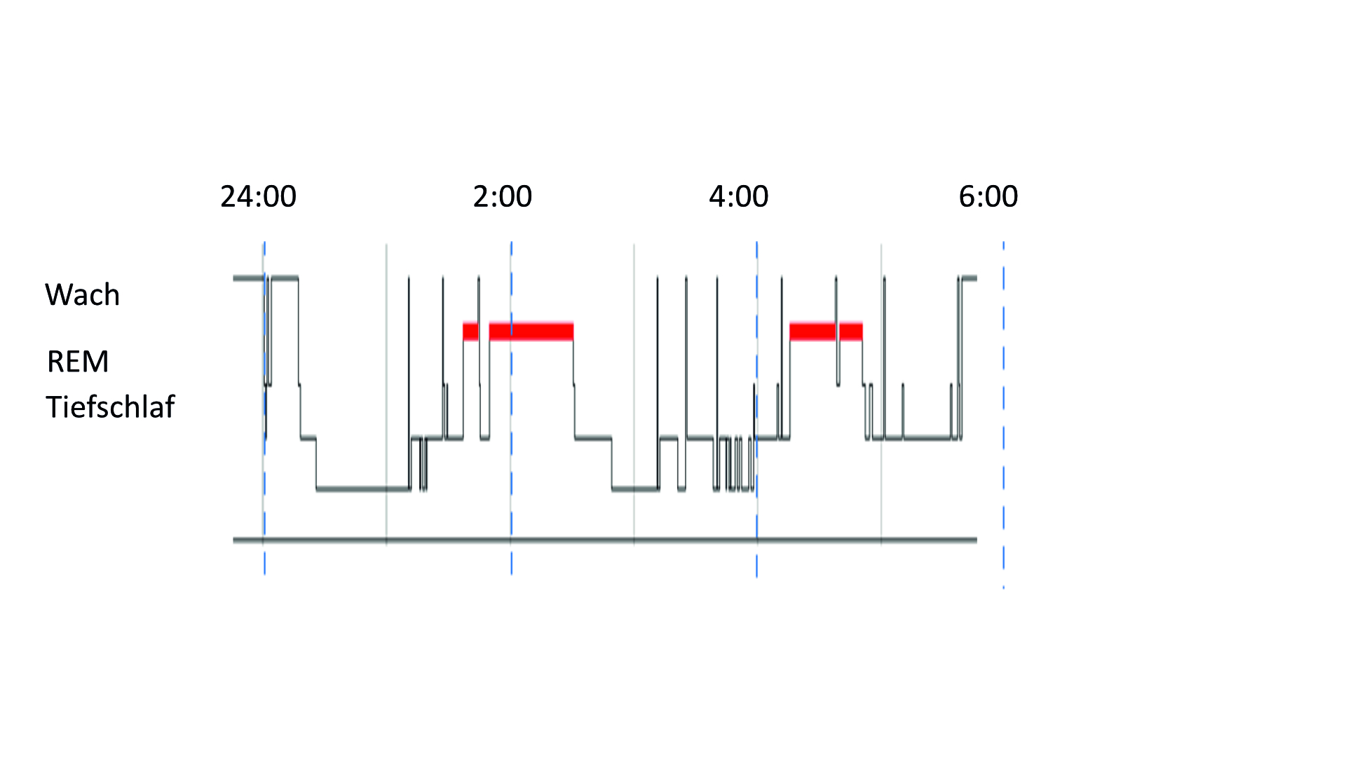 Schlaf- und Atmungsstörungen — American Sleep Clinic Frankfurt am Main